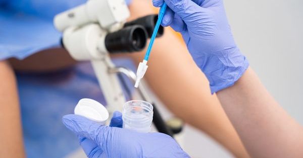 Cervical cancer screening and self-sampling