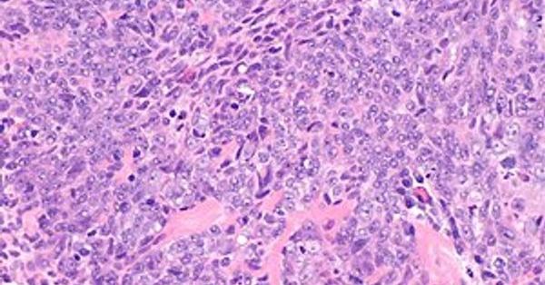 Cancer datasets and tissue pathways