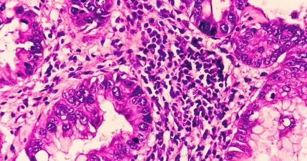 Putting the puzzle together – the secrets of an efficient digital ...