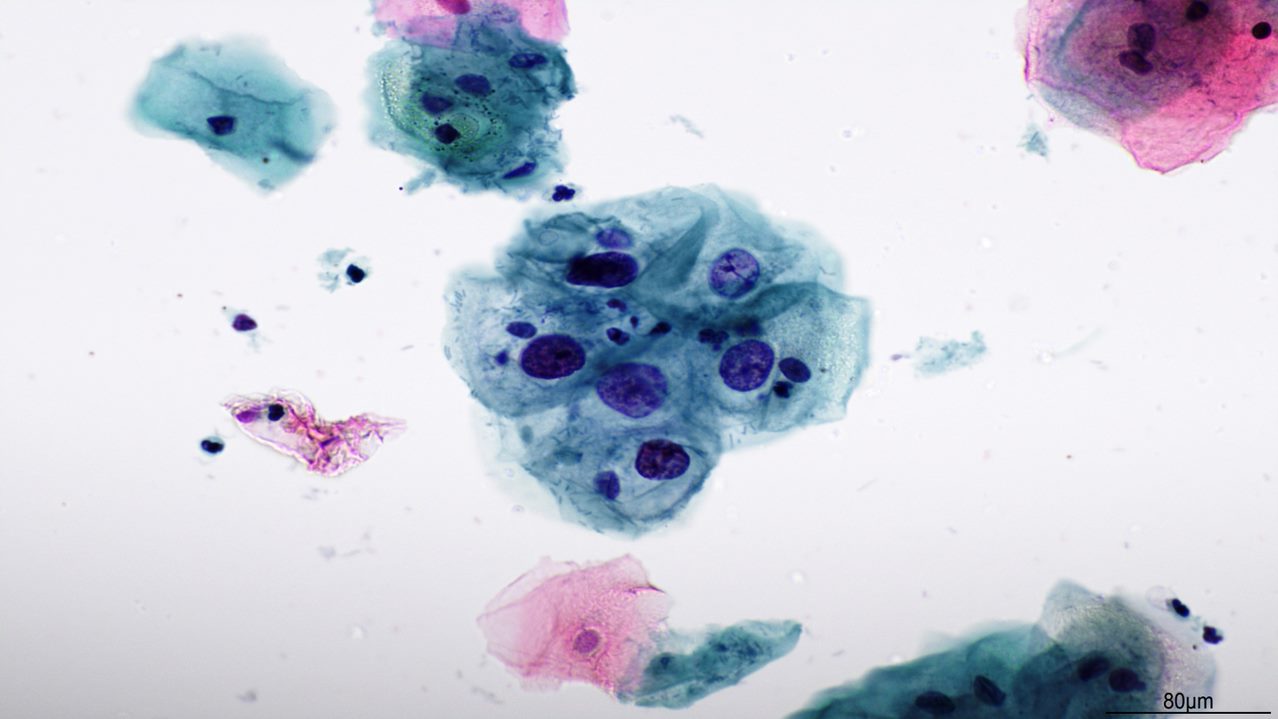 Cytopathology – the dark art that came into the light